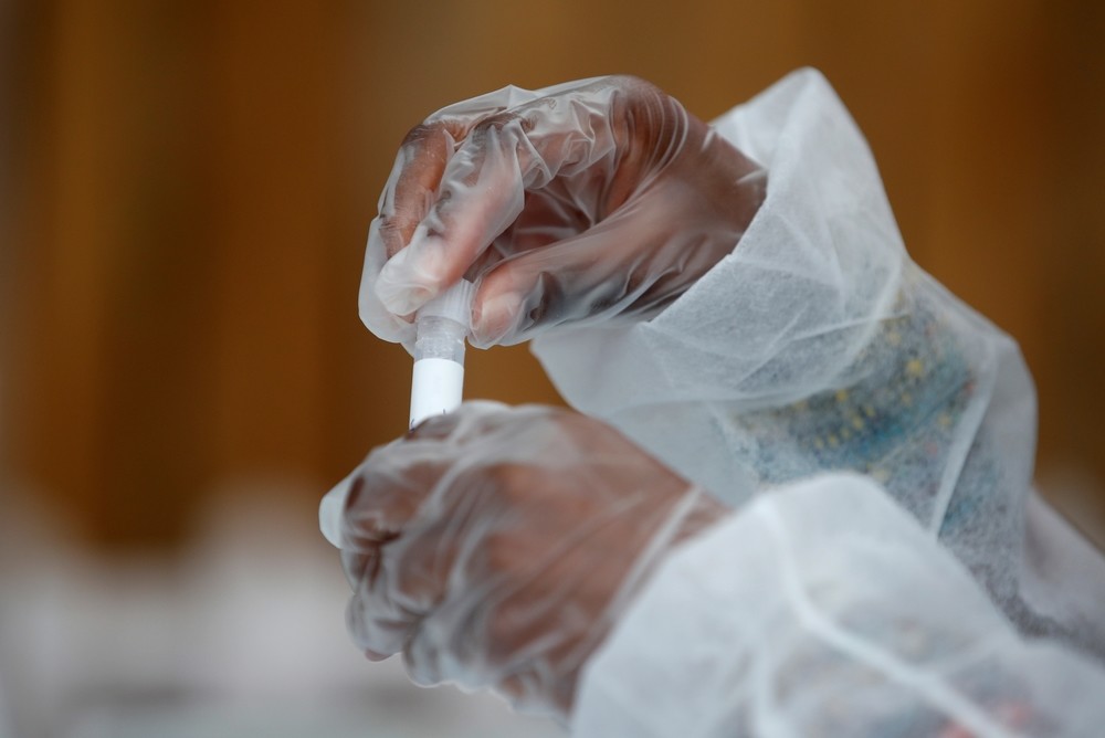 Holanda y Bélgica registran también casos de reinfección | Noticias La ... Holanda y Bélgica registran también casos de reinfección | Noticias La ...